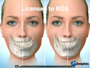 Orthognathic Jaw Surgery Sheffield - Nicholas Lee Surgery